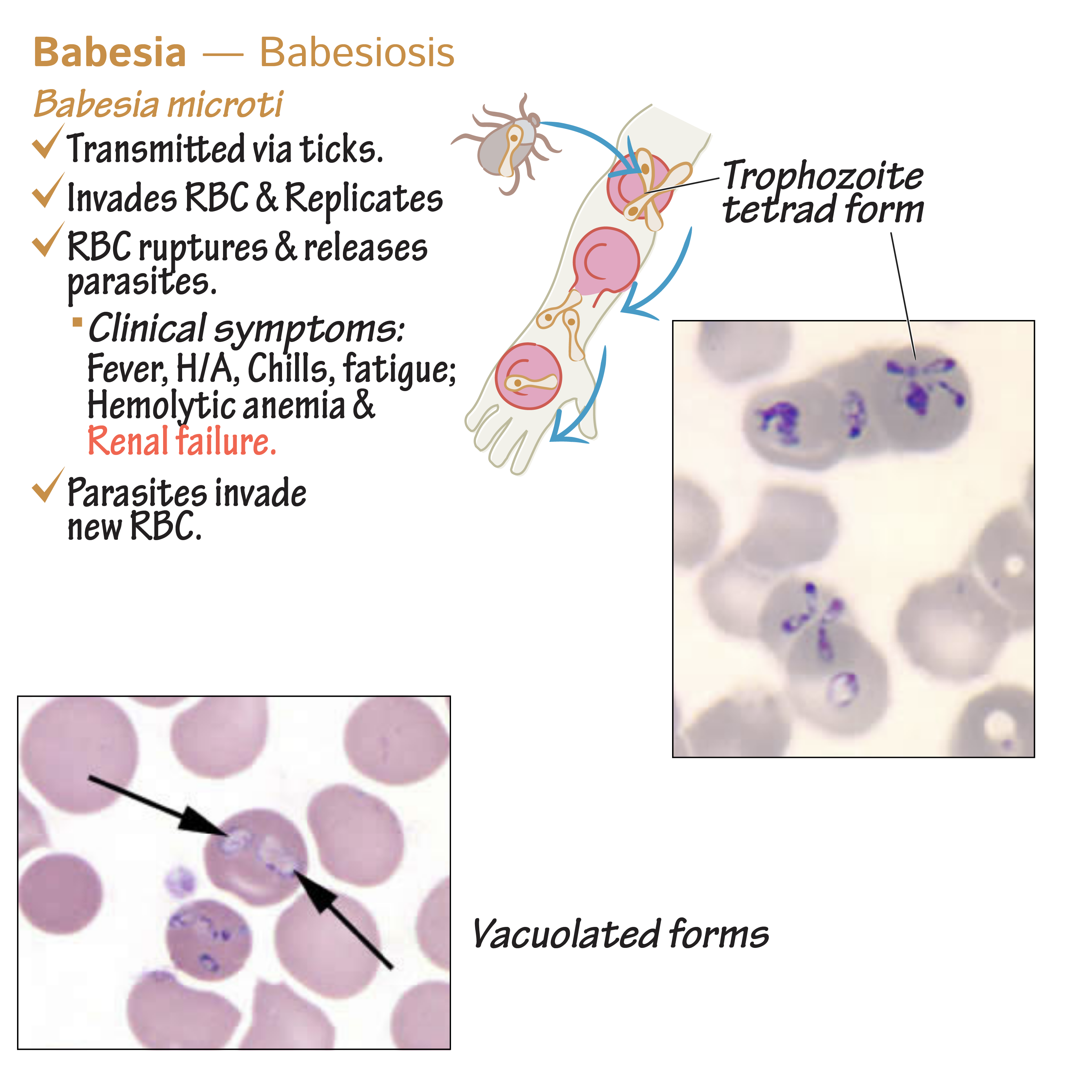 Immunology/Microbiology Glossary: Protozoa - Babesia & Babesiosis ...