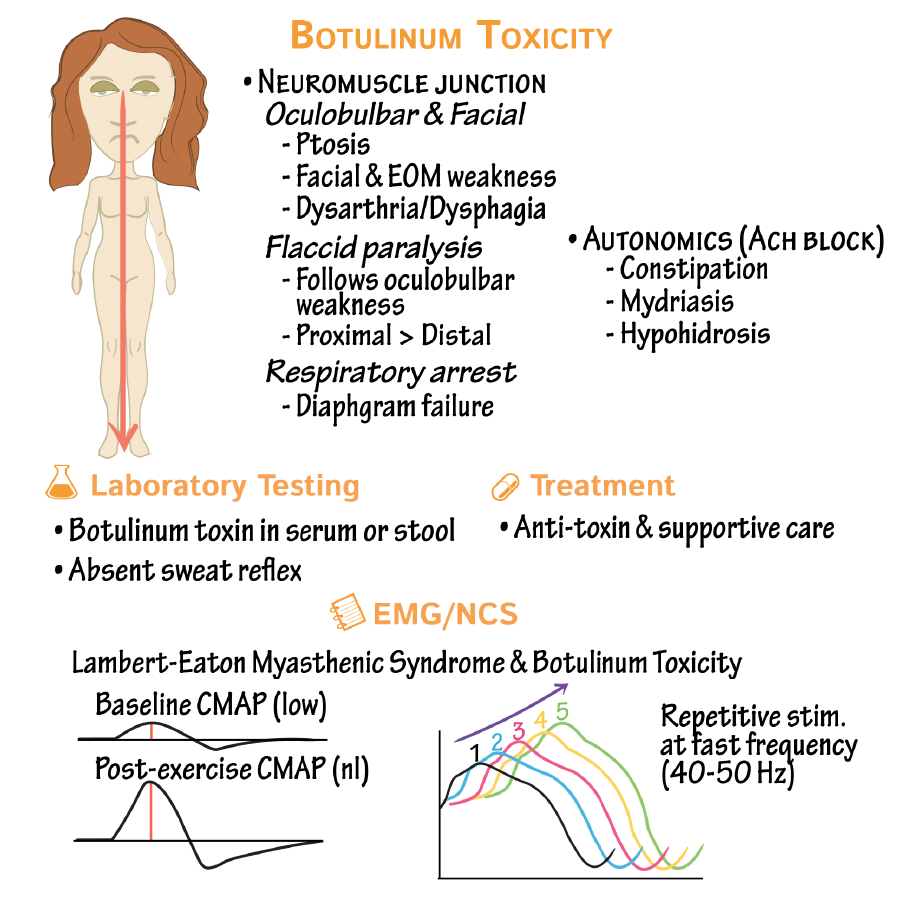 Clinical Pathology Glossary: Neuromuscular Junction Disorders ...