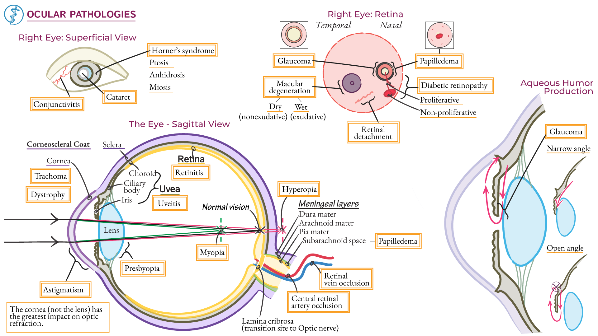 Clinical Pathology: Ocular Pathologies | ditki medical & biological ...