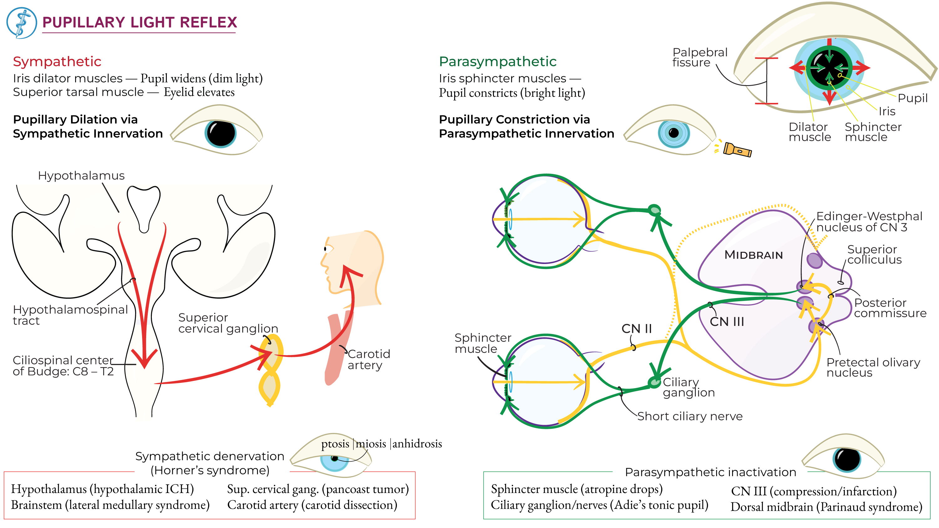 Neurology - ABPN MOC: Pupillary Light Reflex | ditki medical ...