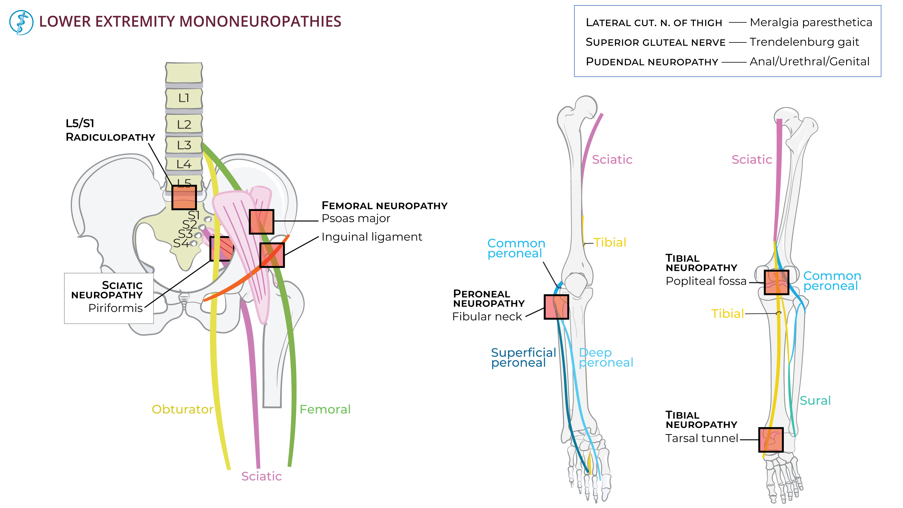 Neuroanatomy: Lower Extremity Mononeuropathies | ditki medical ...