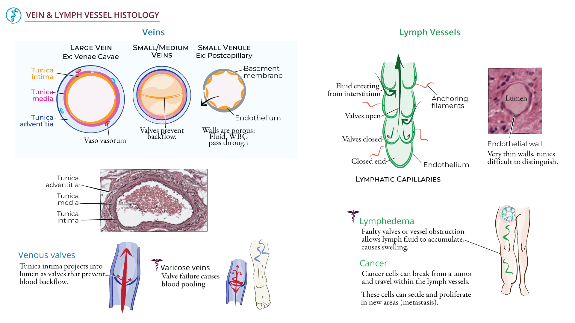 Histology: Veins and Lymphatic Vessels | ditki medical & biological ...