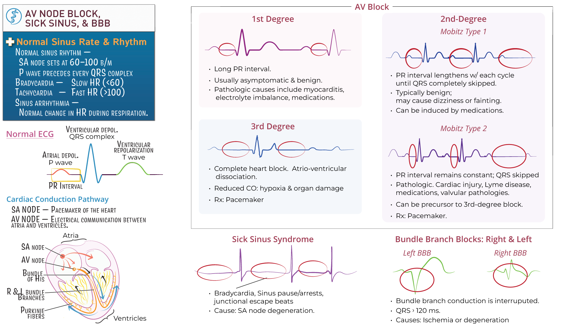 USMLE COMLEX Step 1 AV Node Block Sick Sinus Syndrome Bundle USMLE COMLEX Step 1 AV Node Block Sick Sinus Syndrome Bundle