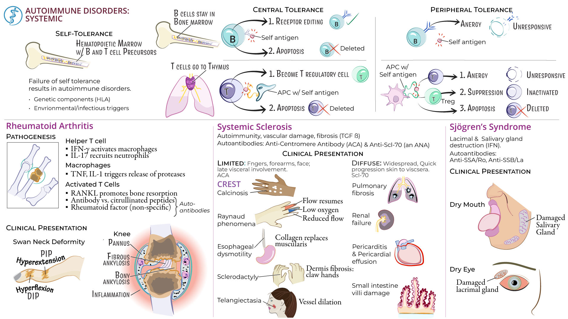 Advanced Anatomy & Physiology: Autoimmune Disorders (Systemic Overview ...