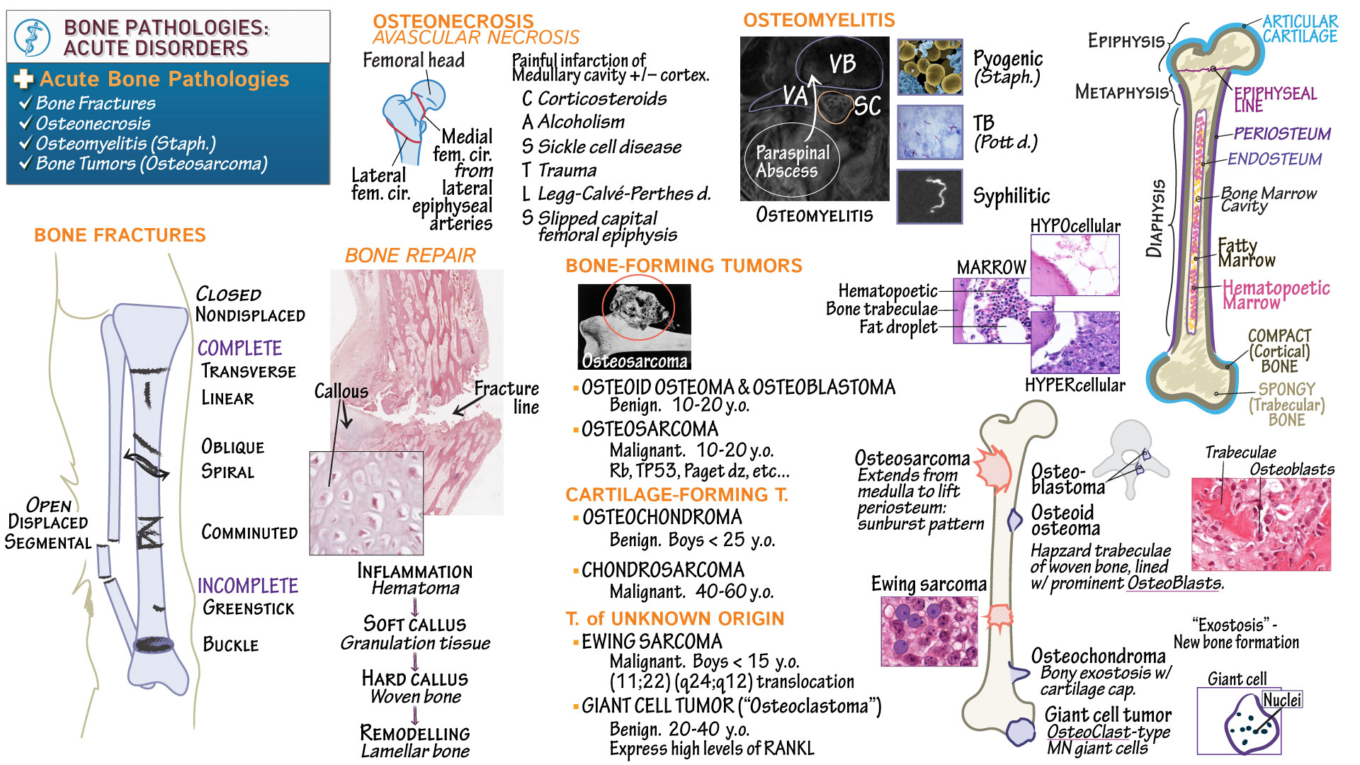 Clinical Pathology: Acute Bone Pathologies | ditki medical & biological sciences