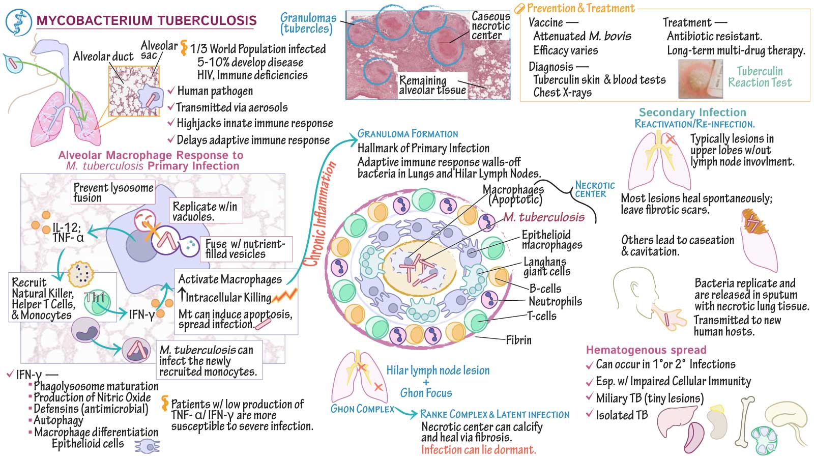 Immunology / Microbiology: Mycobacterium tuberculosis: Pulmonary ...