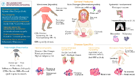 USMLE / COMLEX - Step 1: Dermatomyositis, Polymyositis, Polymyalgia ...