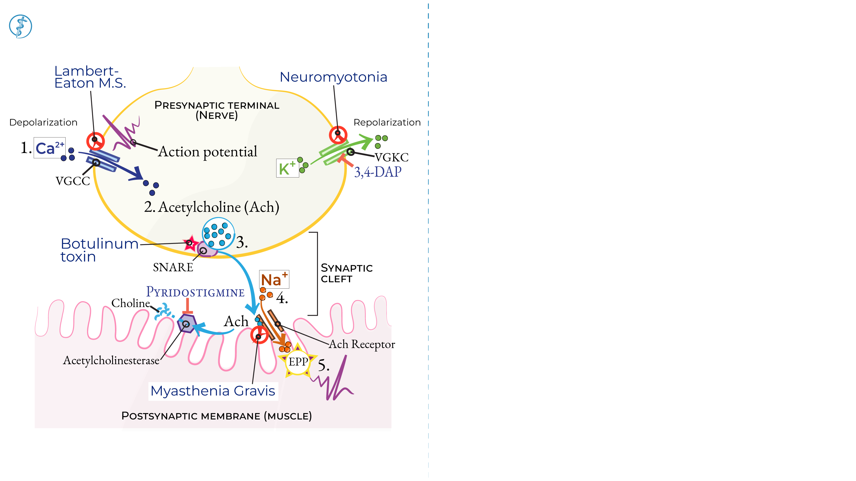 Clinical Pathology: Neuromuscular Junction Pathophysiology | ditki ...
