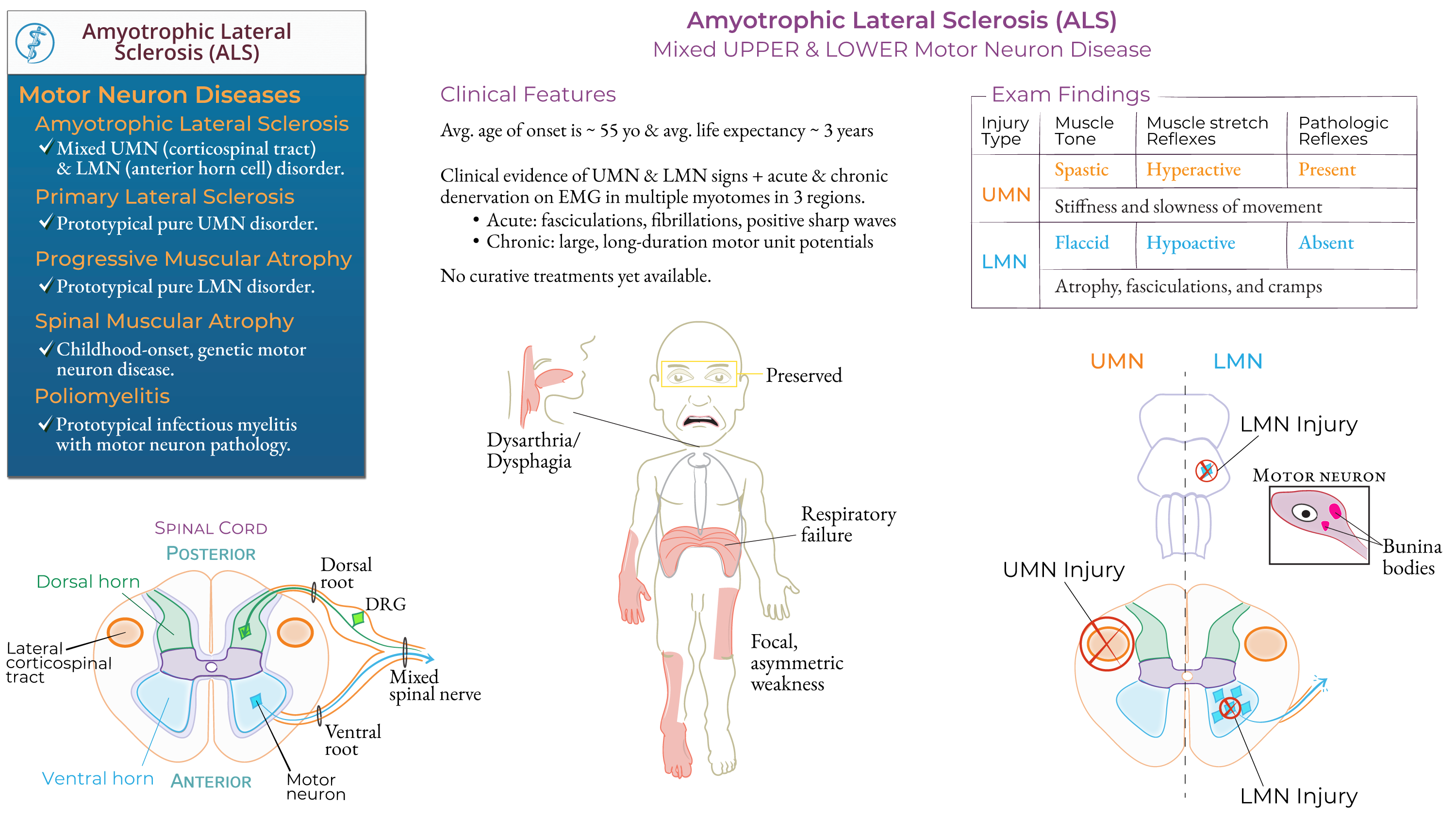 Clinical Pathology: Amyotrophic Lateral Sclerosis (ALS) | ditki medical & biological sciences