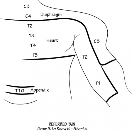 Neuroanatomy: Referred Pain | ditki medical & biological sciences