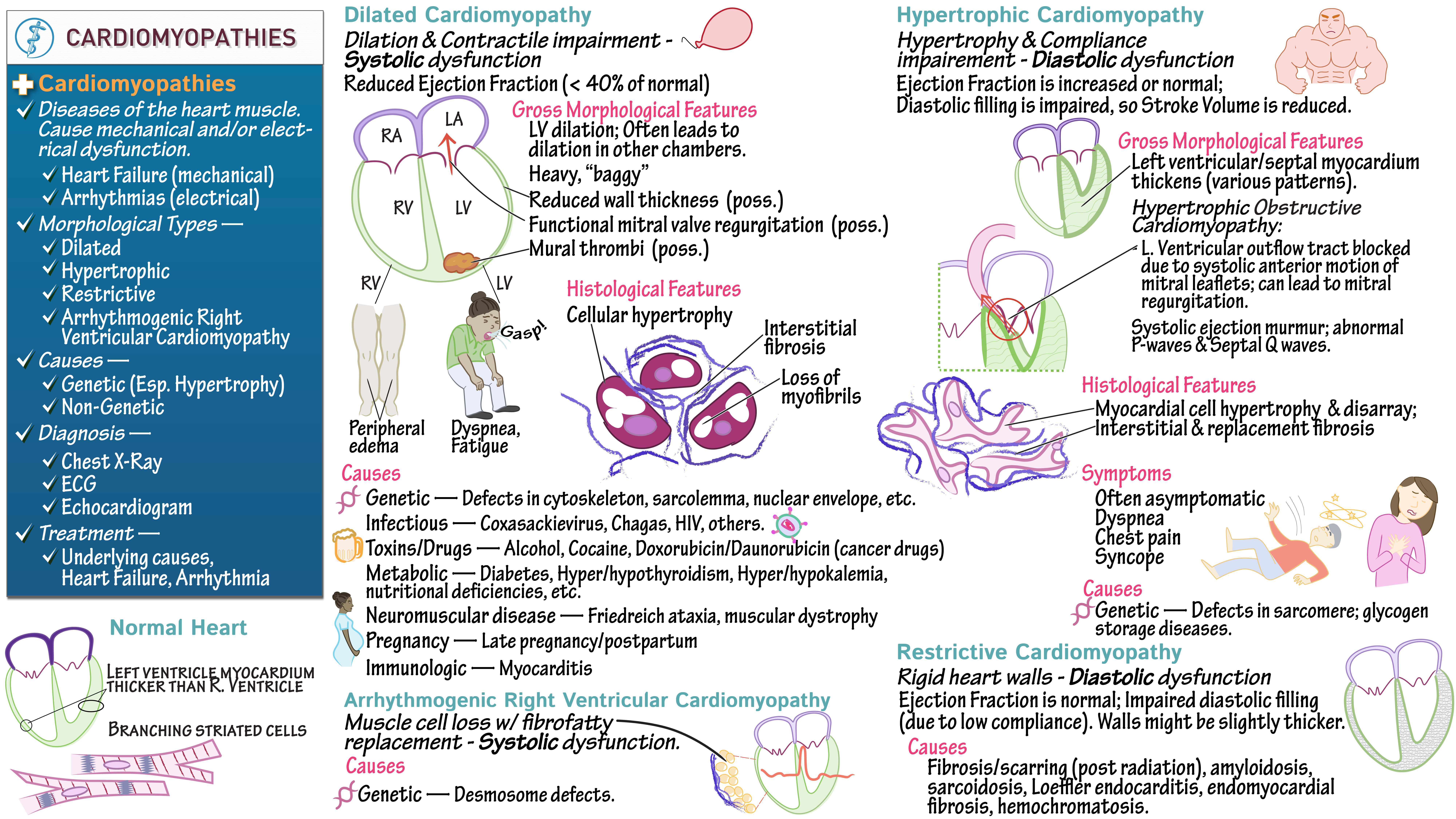 USMLE / COMLEX - Step 1: Cardiomyopathies | ditki medical & biological ...