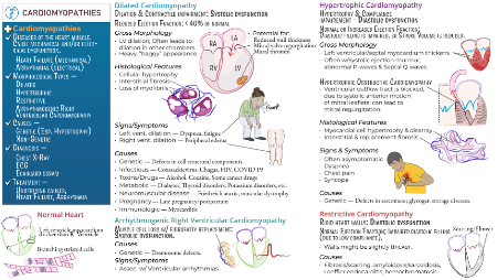 A&P for Nurses: Cardiomyopathies | ditki medical & biological sciences