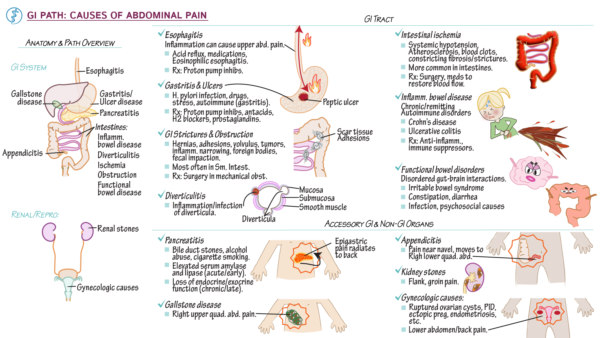 PAS 6029: Pathophysiology II: GI Pathology: Abdominal Pain | Draw It to ...
