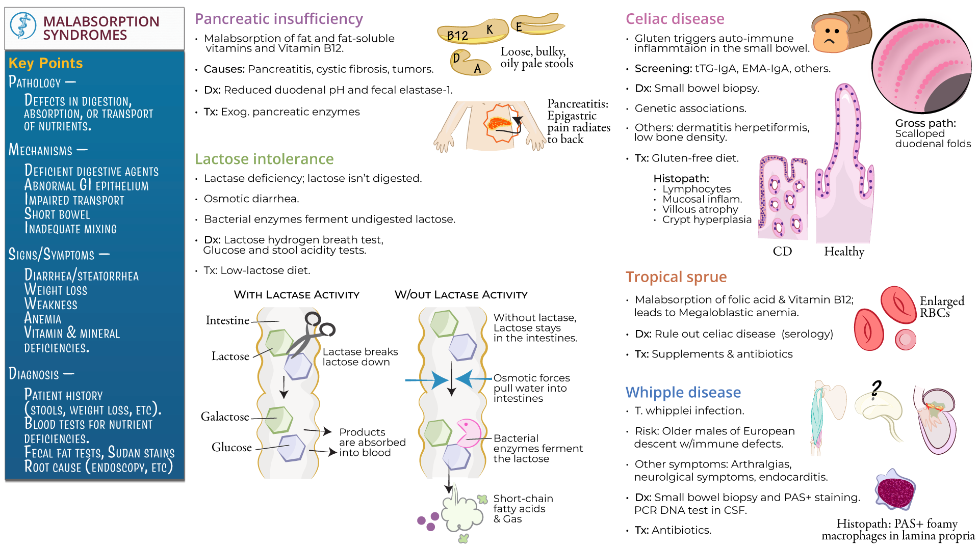 USMLE / COMLEX - Step 1: Malabsorption Syndromes (Pancreatic Insuff., Lactose Intolerance ...