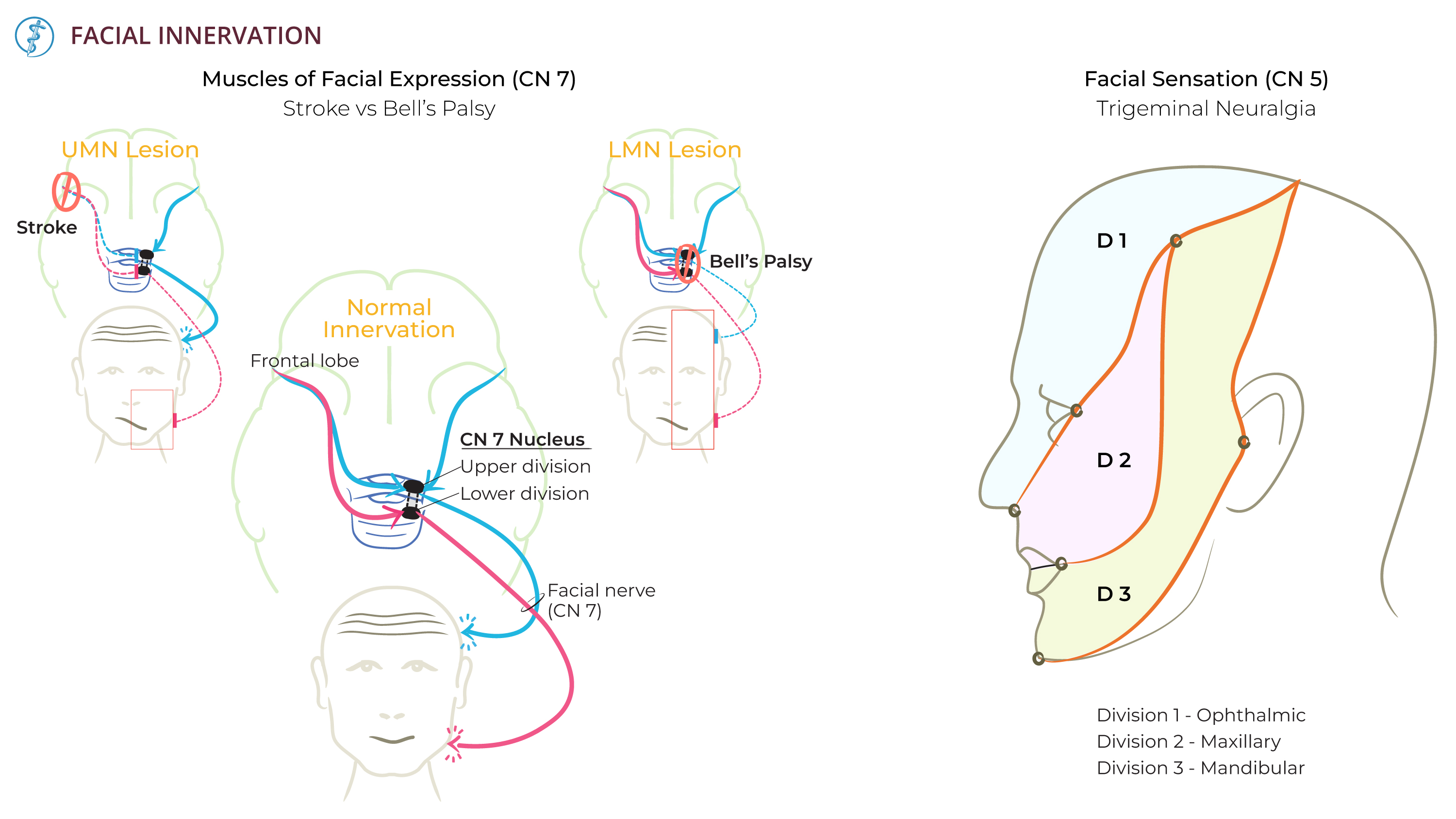 Neuroscience Fundamentals: Facial Innervation (Stroke vs Bell's Palsy ...