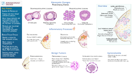 Clinical Pathology: Benign Breast Diseases (Mastitis, Fibrocystic ...
