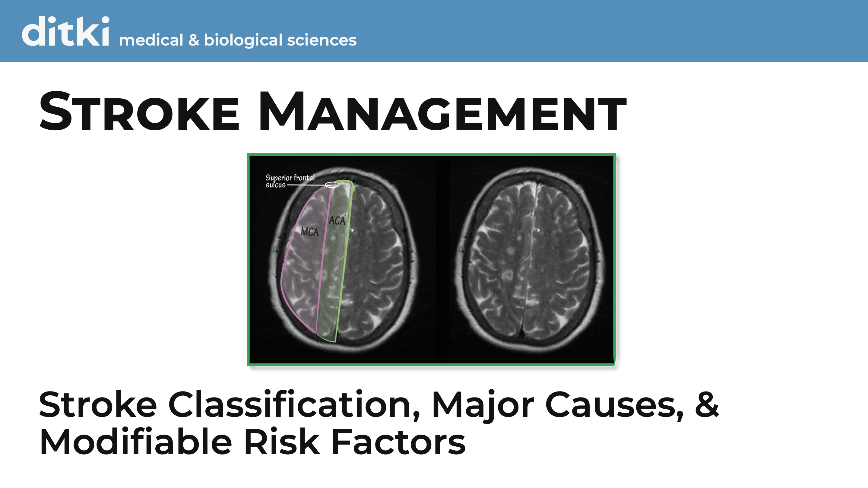 A&P for Nurses: Stroke Risk Factors | ditki medical & biological sciences