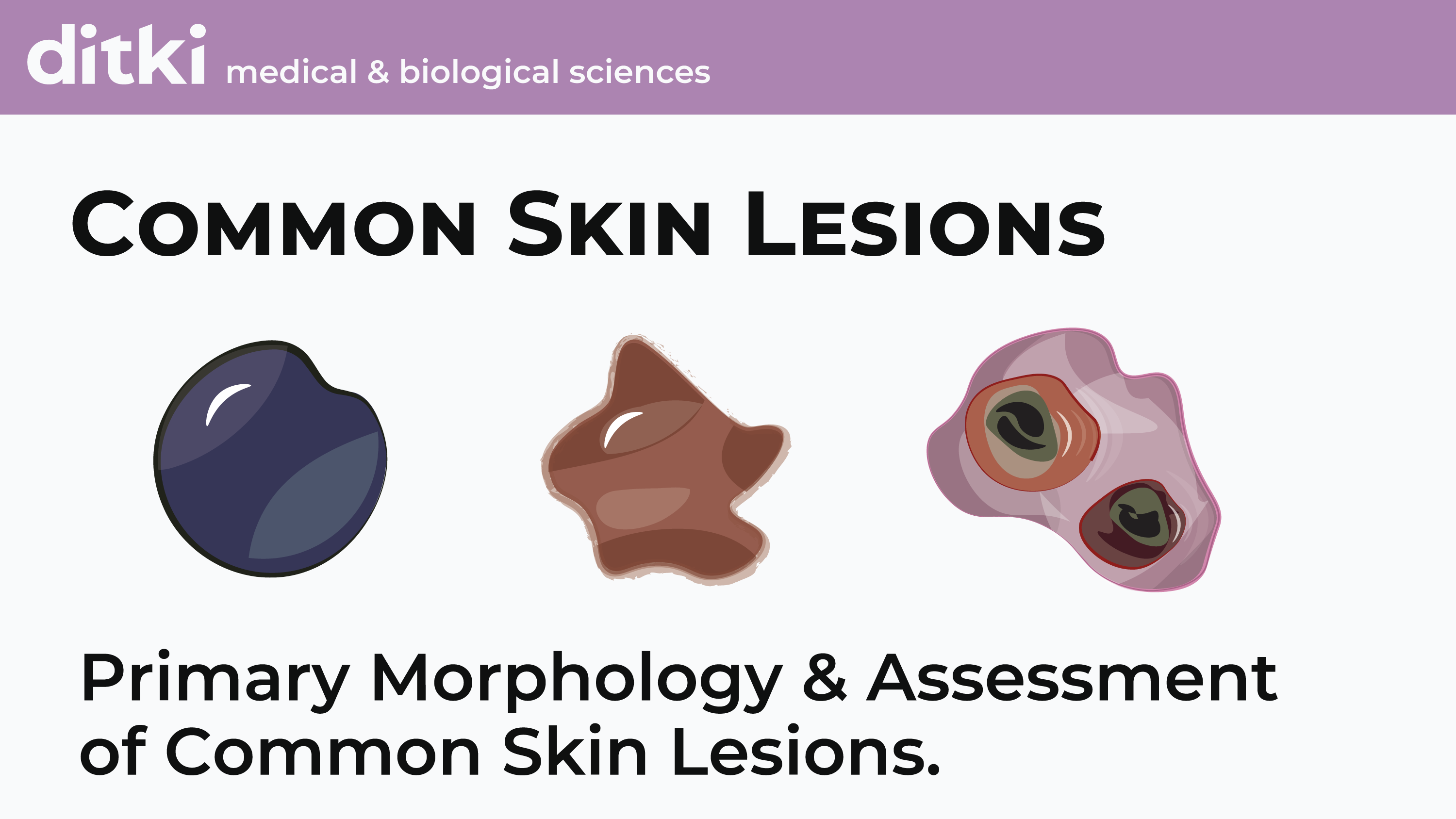 Clinical Medicine: Common Skin Lesions | ditki medical & biological sciences