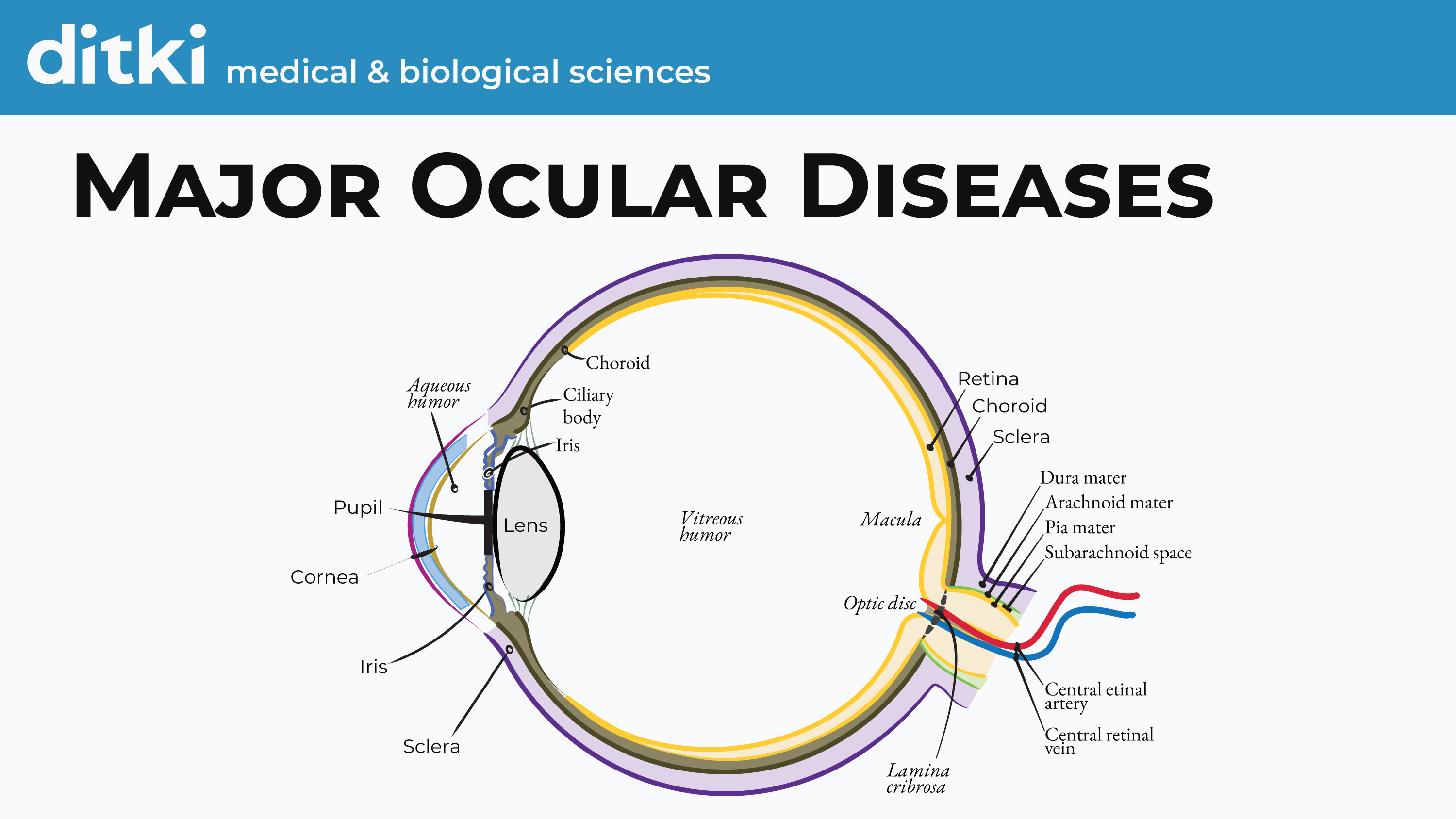 Clinical Medicine: Major Ocular Diseases | ditki medical & biological ...