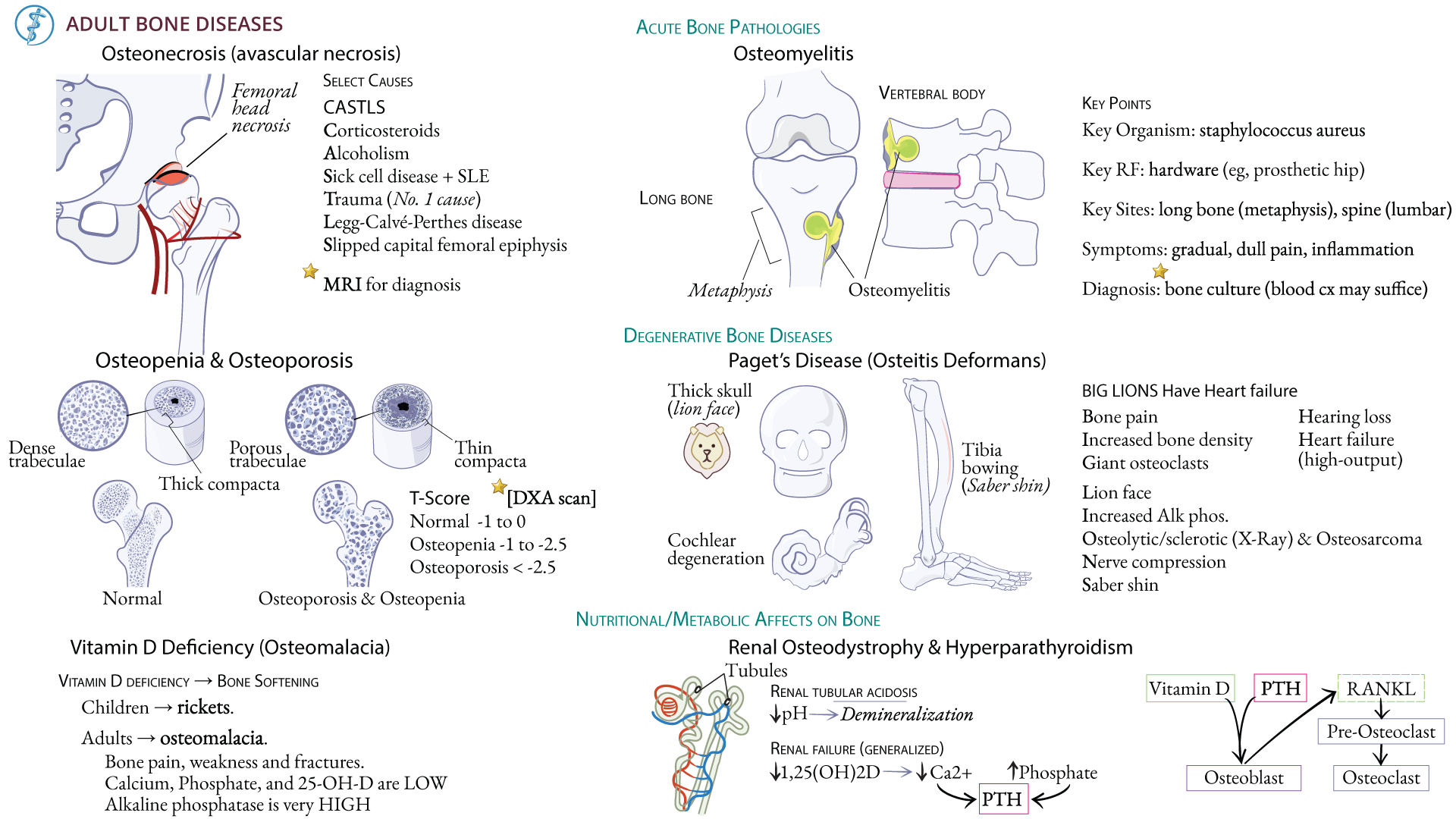 Clinical Pathology: Adult-Onset Bone Diseases | ditki medical ...