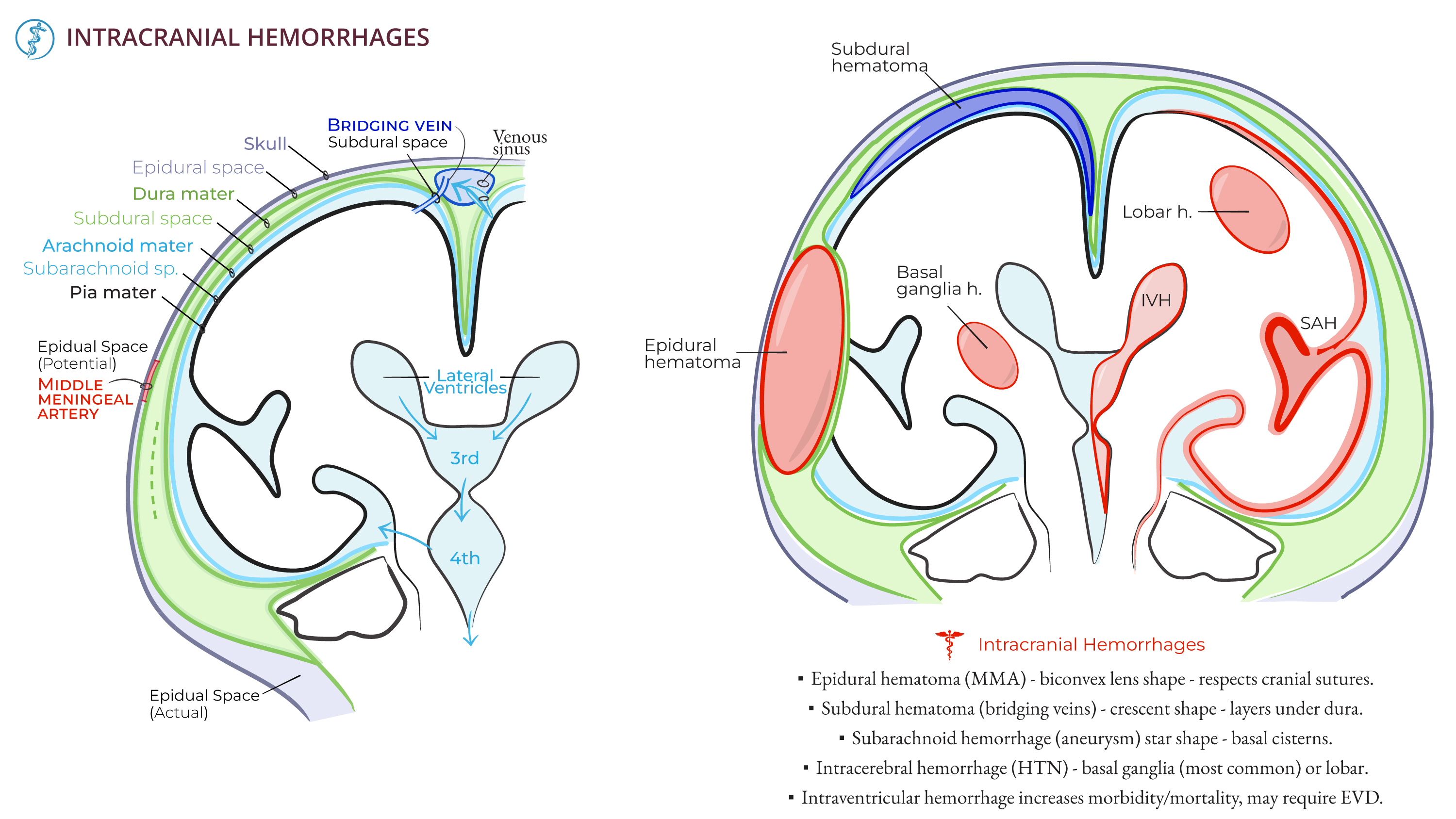 Clinical Medicine: Intracranial Hemorrhage | ditki medical & biological ...