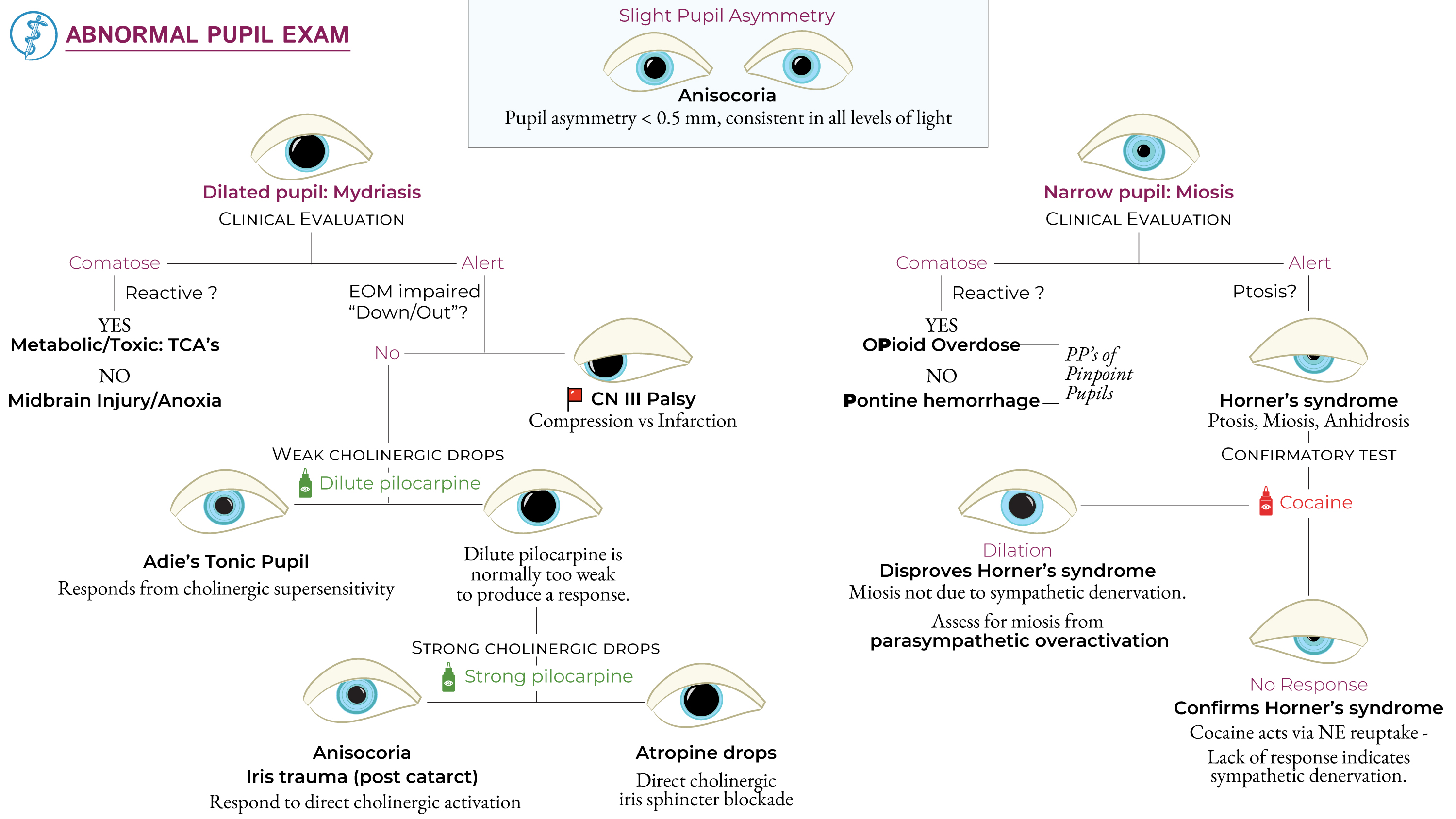 Pinpoint Pupils Differential Diagnosis
