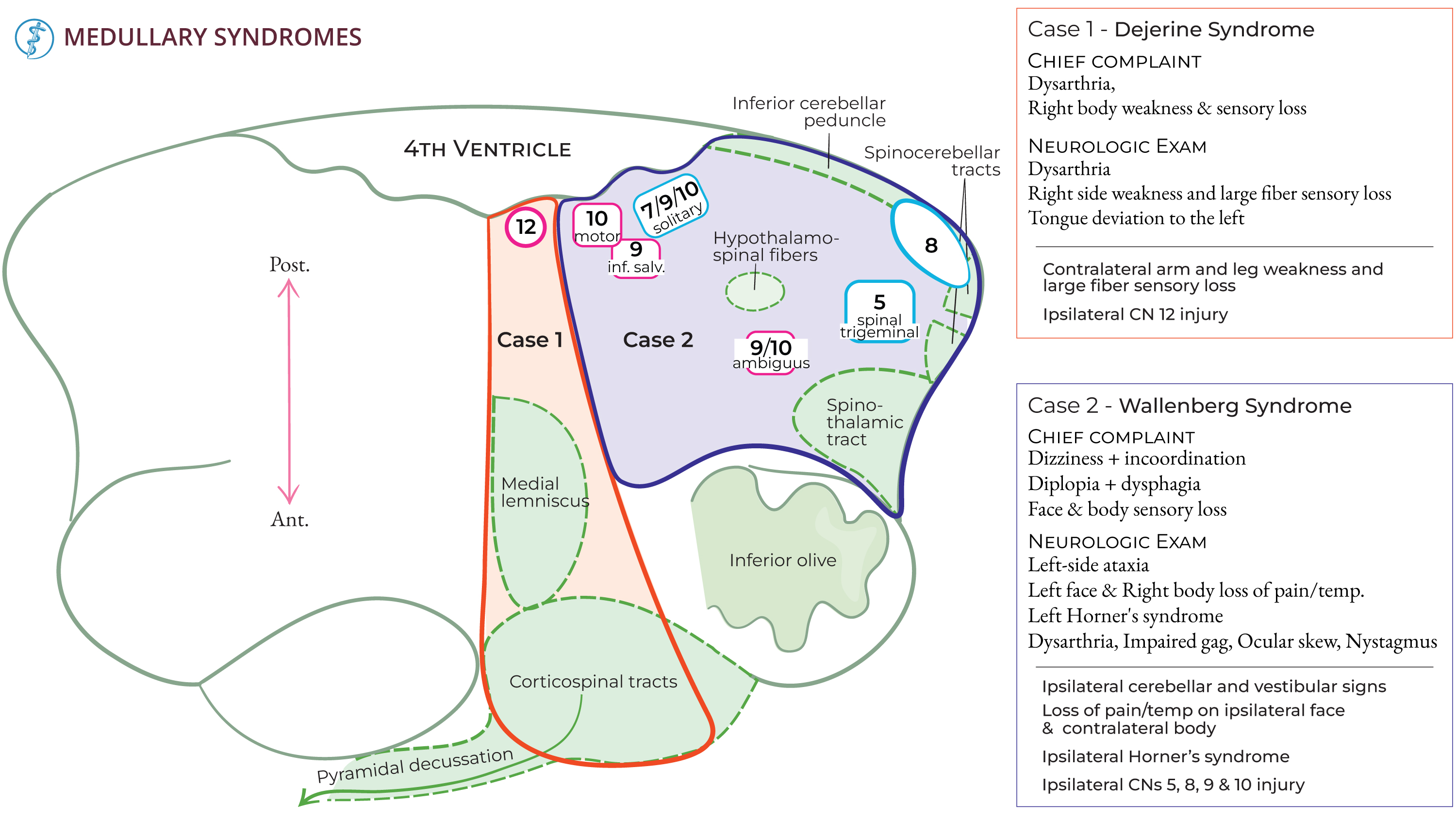 Neuroanatomy: Medullary Syndromes | ditki medical & biological sciences