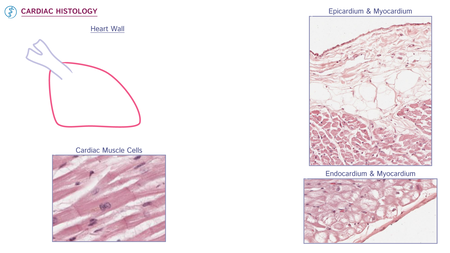 Cardiovascular System: Cardiac Histology | ditki medical & biological sciences