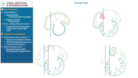 Embryology: Atrial Septation & Differentiation | ditki medical ...