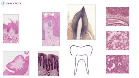 Gross Anatomy: Oral Cavity Histology | ditki medical & biological sciences