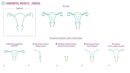 Gross Anatomy: Congenital Anomalies of the Uterus and Vagina | ditki ...