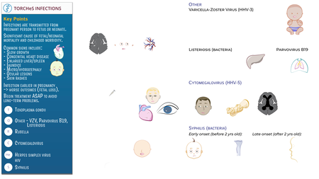 Clinical Medicine: Congenital Infections (TORCHeS) | ditki medical ...