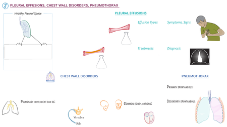 Clinical Pathology: Pleural Effusions & Chest Wall Disorders | ditki ...