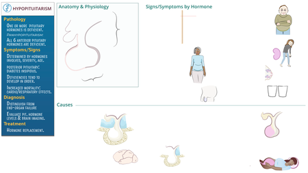 Clinical Pathology: Hypopituitarism | ditki medical & biological sciences