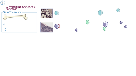 PAS 6028: Pathophysiology I: Self-Tolerance (Immune System) | ditki ...