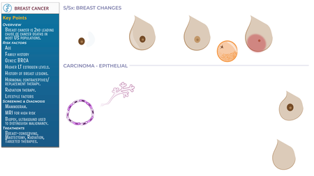 Clinical Pathology: Breast Cancer | ditki medical & biological sciences