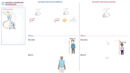 Clinical Pathology: Growth Hormone Pathology | ditki medical ...