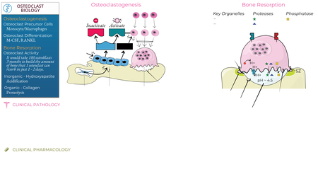 Gross Anatomy: Bone Resorption | ditki medical & biological sciences
