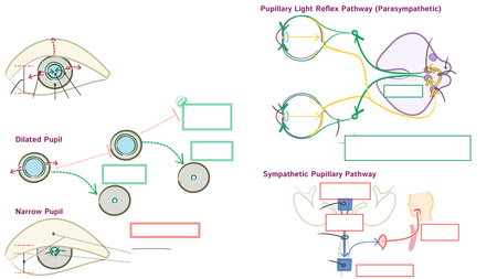 Clinical Pathology: Pupillary Reflex Pathologies | ditki medical ...