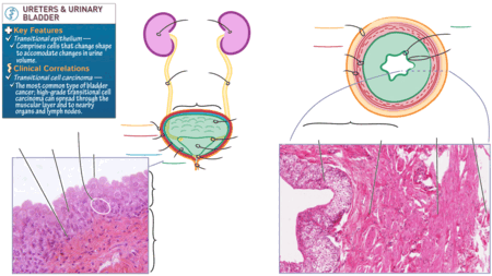 Renal System: Ureters and Urinary Bladder (urothelium) | ditki medical ...