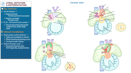 Embryology: Atrial Septation & Differentiation | ditki medical ...