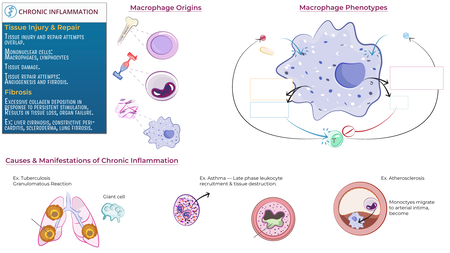 Immunology - Marian: Chronic Inflammation | ditki medical & biological ...