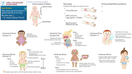Immunology / Microbiology: Viral Childhood Exanthems | ditki medical ...