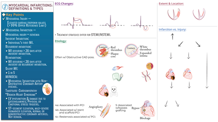 Cardiovascular System: Myocardial Infarction: Definitions & Types ...