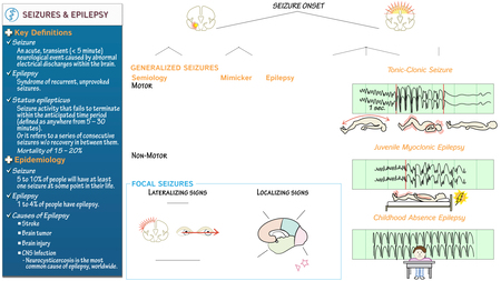 USMLE / COMLEX - Step 1: Seizures & Epilepsy - Presentation | ditki ...