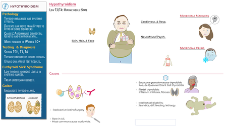 Clinical Pathology: Hypothyroidism | ditki medical & biological sciences
