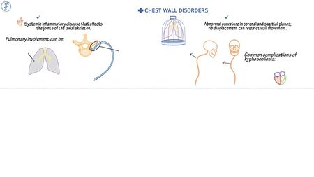 CRNA 510: Pathophysiology: Chest Wall Disorders | ditki medical ...