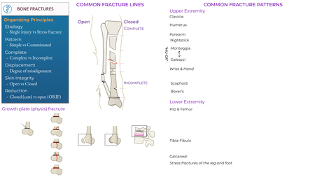 Clinical Pathology: Bone Fractures | ditki medical & biological sciences