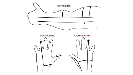 Neuroanatomy: Upper Extremity - Sensory Maps | ditki medical ...